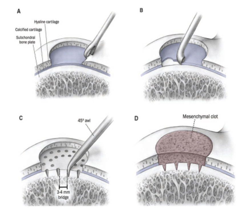 News - Page 4 of 46 - San Mateo Podiatry Group